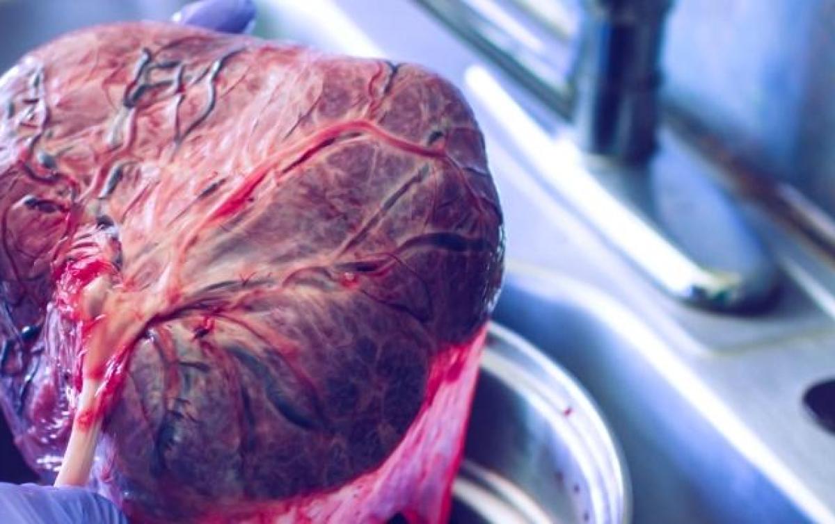 Comer placenta é uma prática natural ou é maluquice? - Vale do Itaunas